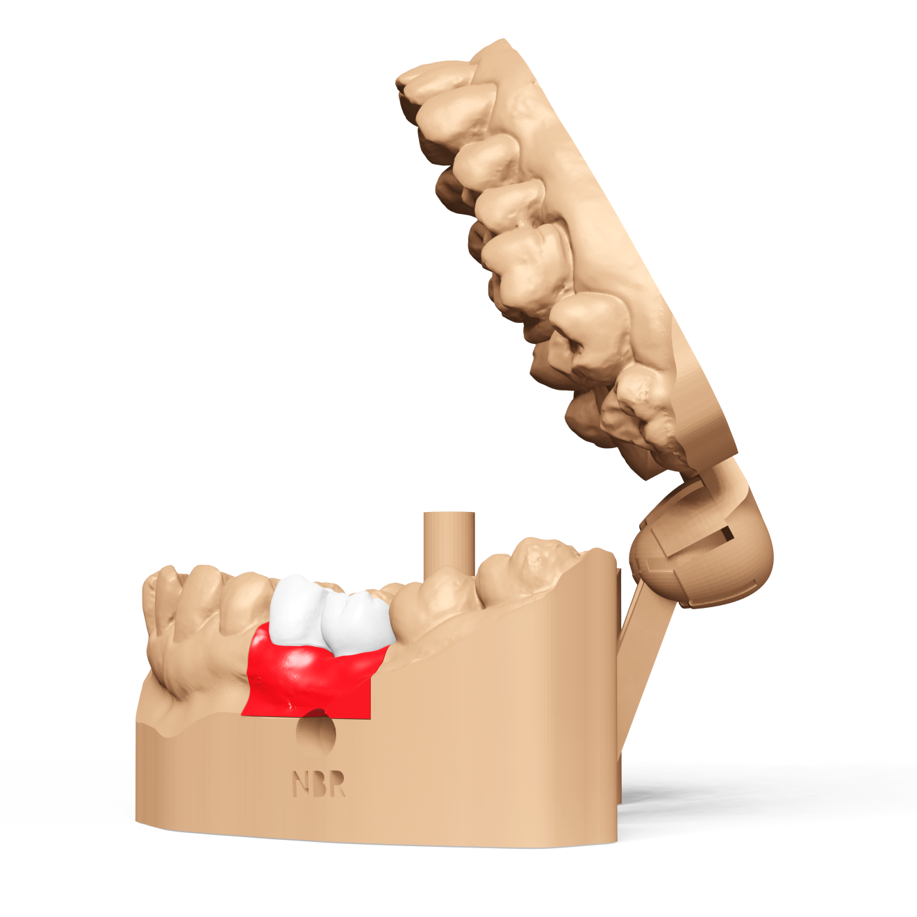 Modelo dental digital - Teseracto